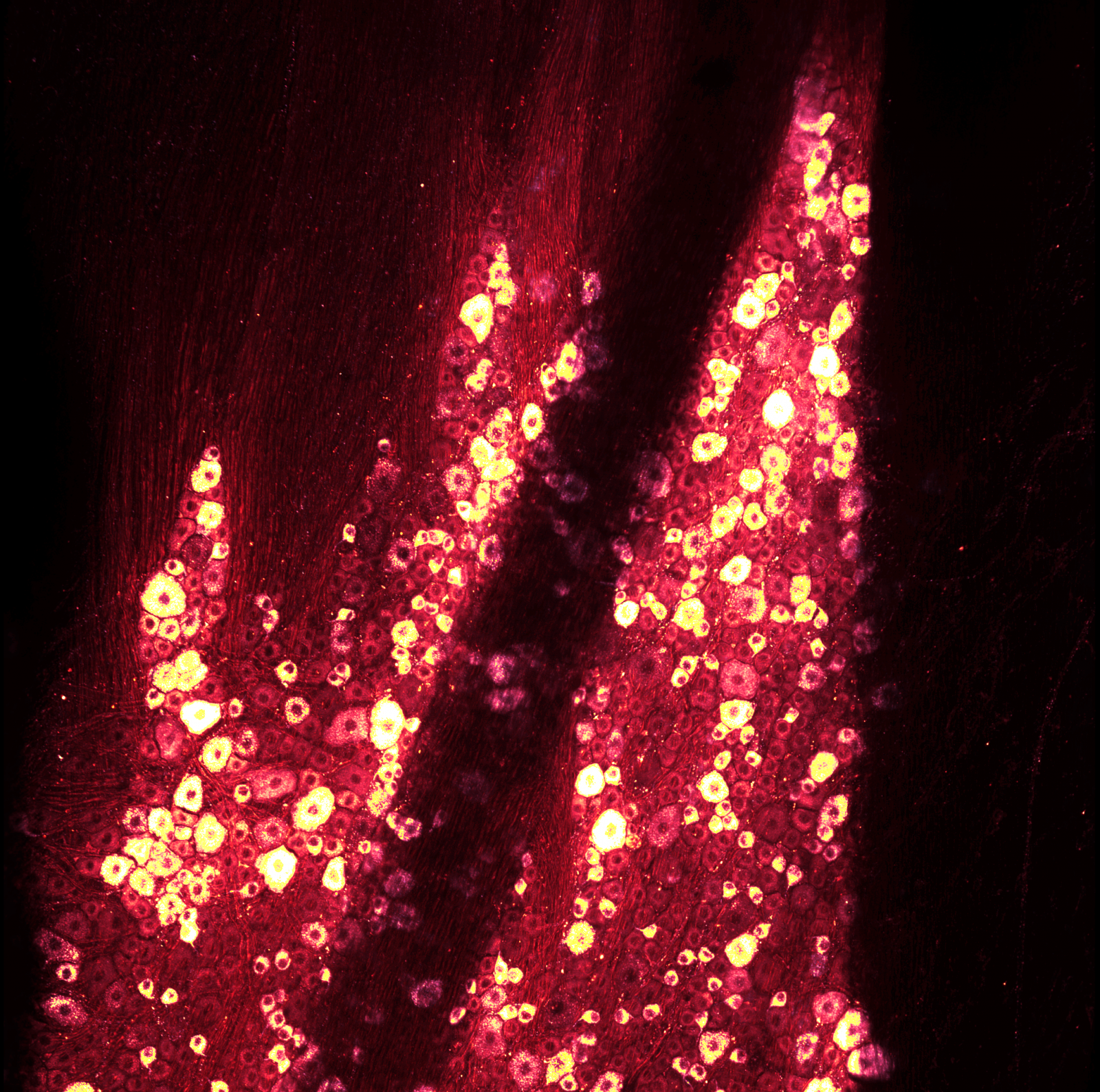 Prestigious $1.3M Keck grant boosts research on alcohol detection ...