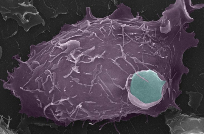 Cells with LIP eat their neighbors | VUMC Reporter | Vanderbilt University